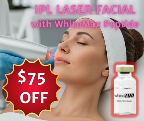 Laser Genesis – IPL – Skin Resurfacing